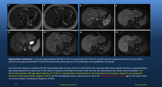 Liver lesions on mri | PDF