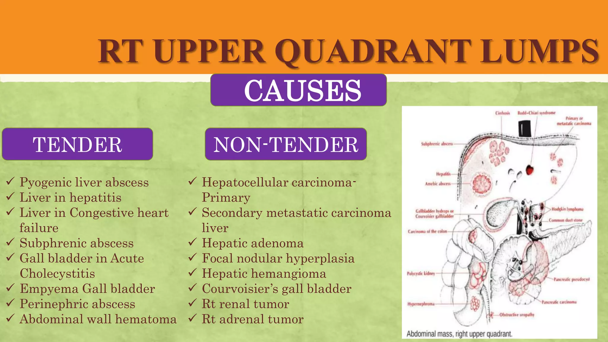 LIVER LUMPS- Rt Upper Quadrant Lumps- Abdominal Lumps.pptx