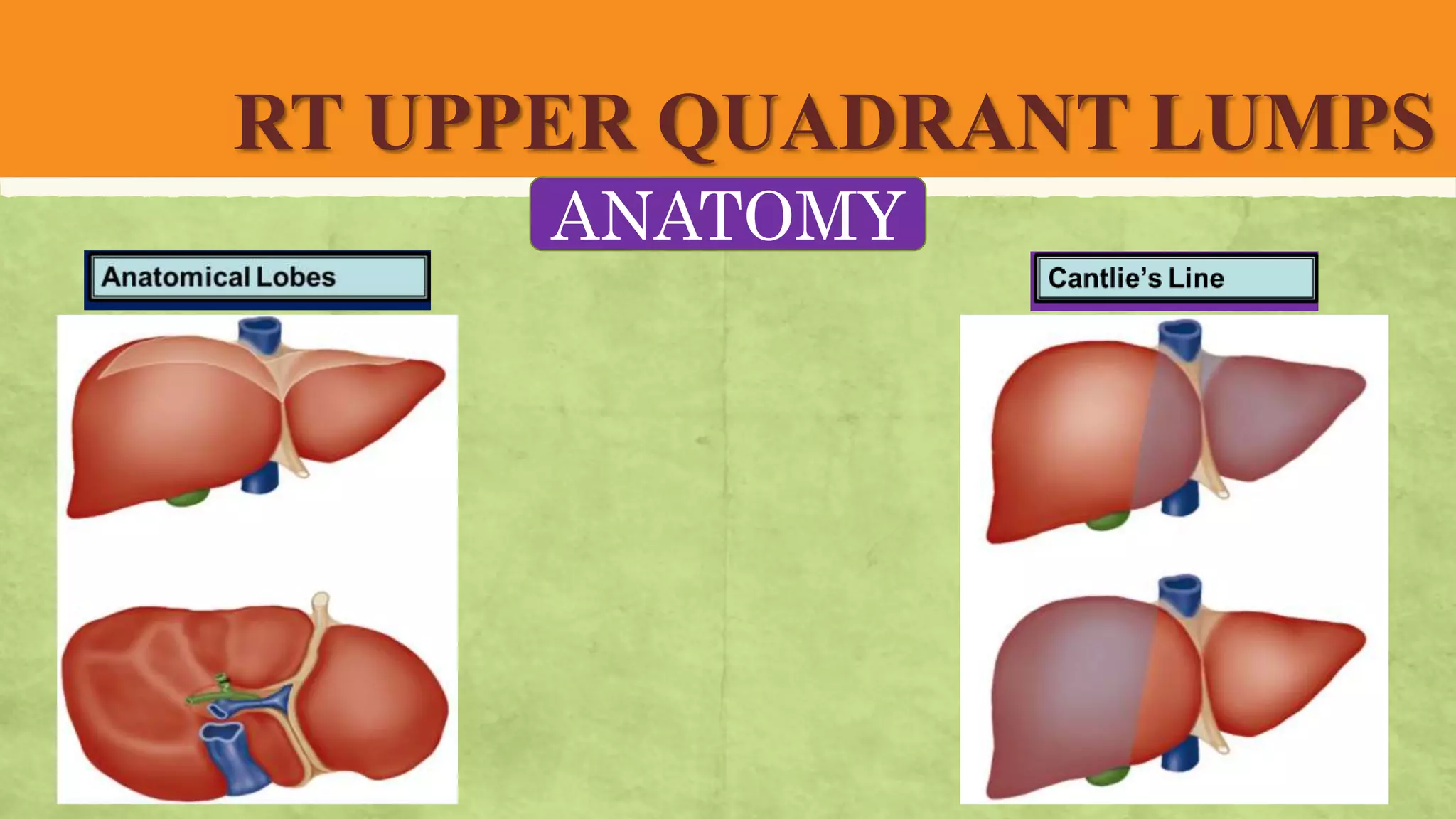 LIVER LUMPS- Rt Upper Quadrant Lumps- Abdominal Lumps.pptx