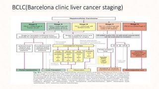 HCC MANGEMENT(RAD ONCO) | PPT