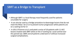 HCC MANGEMENT(RAD ONCO) | PPT