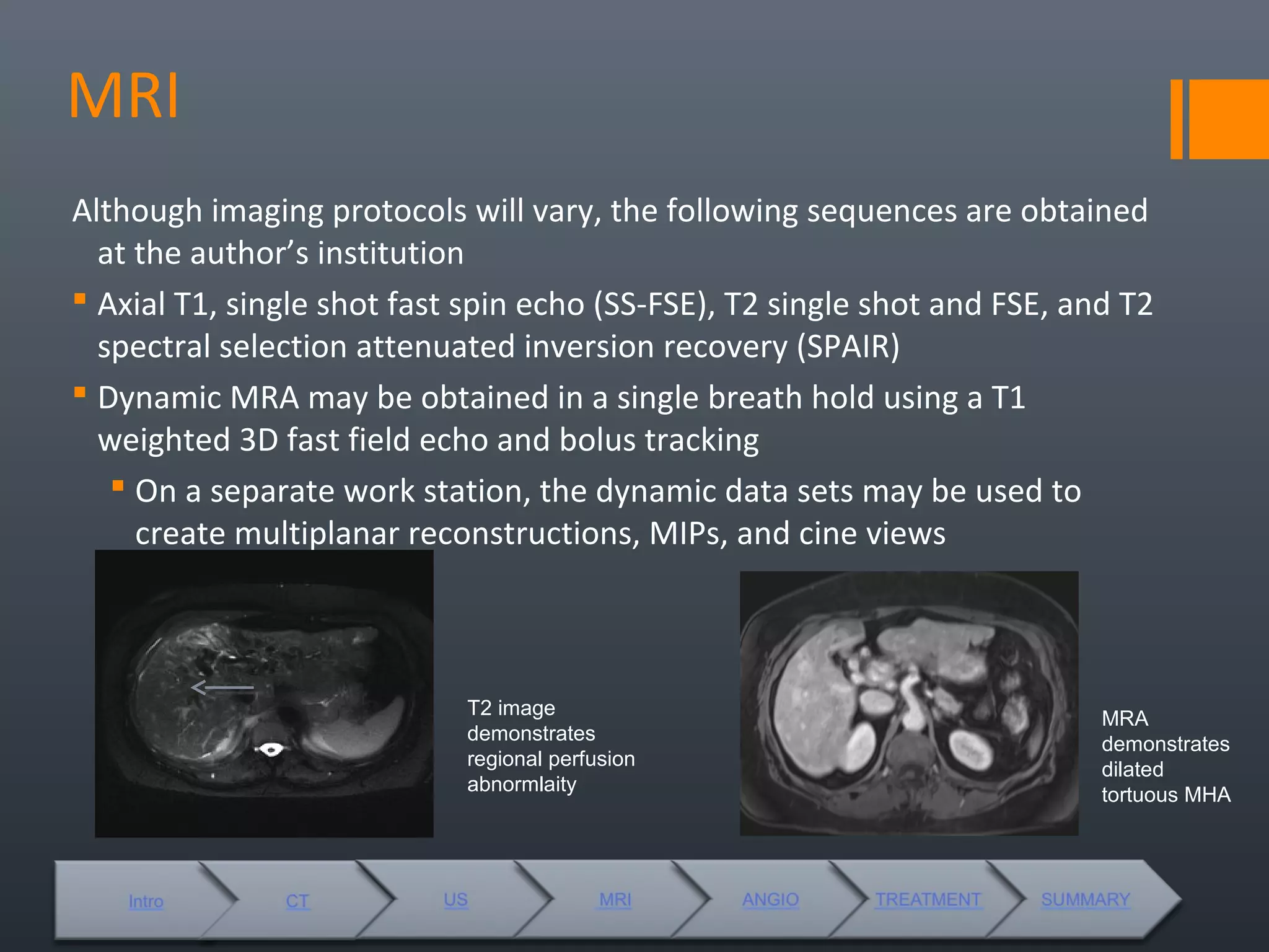 Liver manifestations of hht revised | PPT