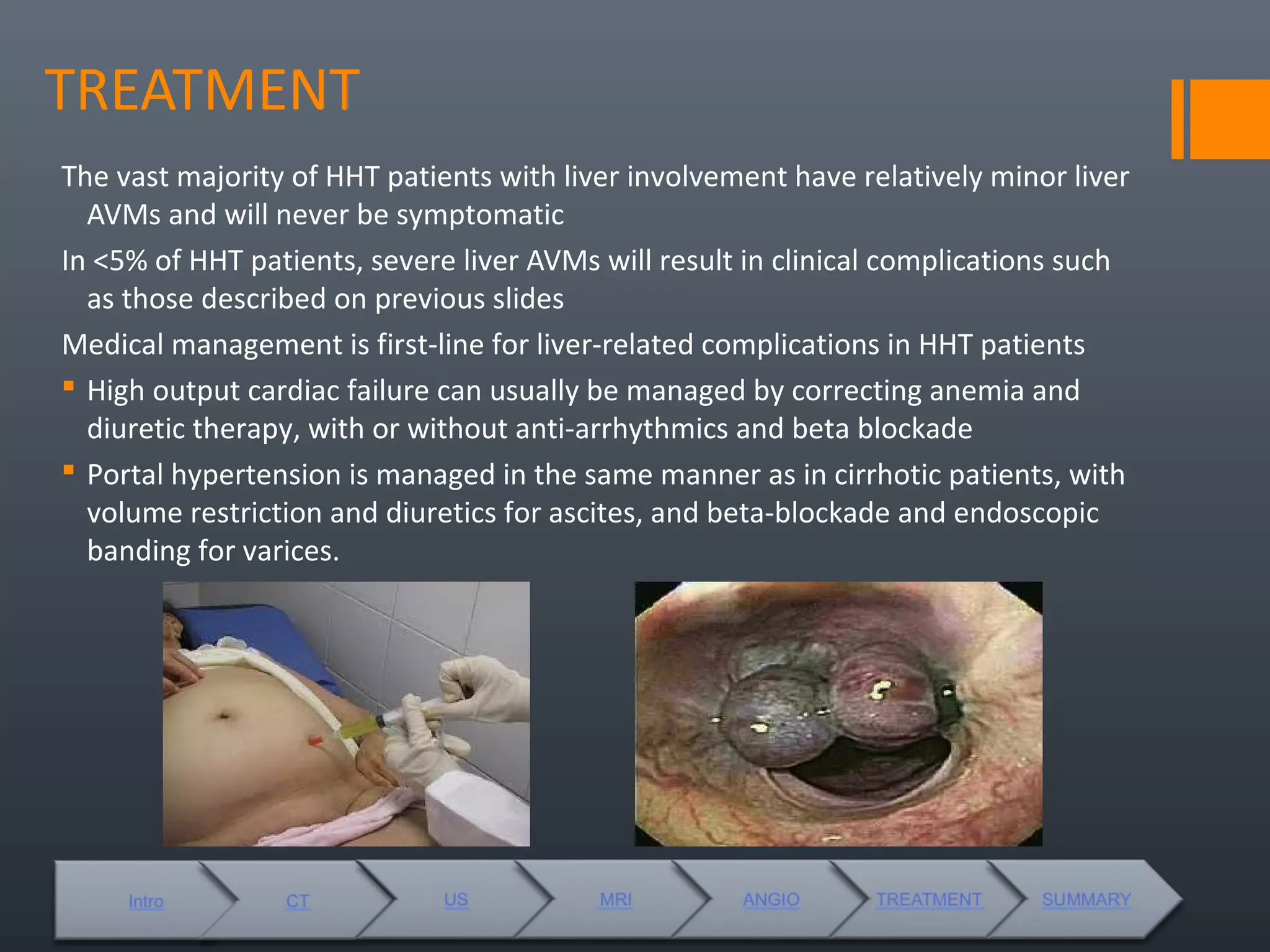 Liver manifestations of hht revised | PPT