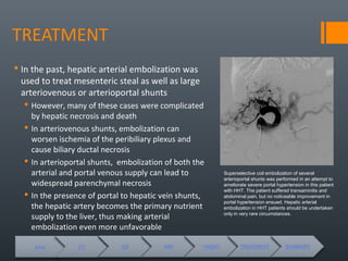 Liver manifestations of hht revised | PPT
