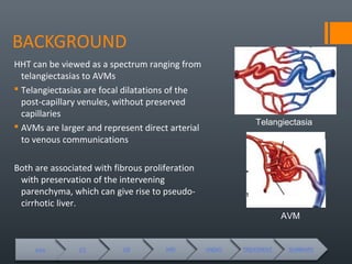Liver manifestations of hht revised | PPT