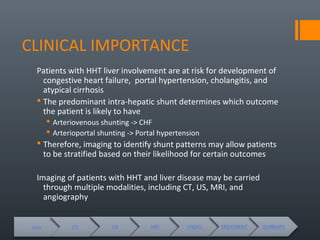 Liver manifestations of hht revised | PPT