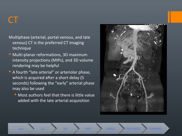 Liver manifestations of hht revised | PPT