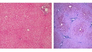 microanatomy and histology of the liver.pptx