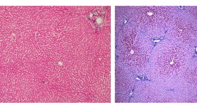 microanatomy and histology of the liver.pptx
