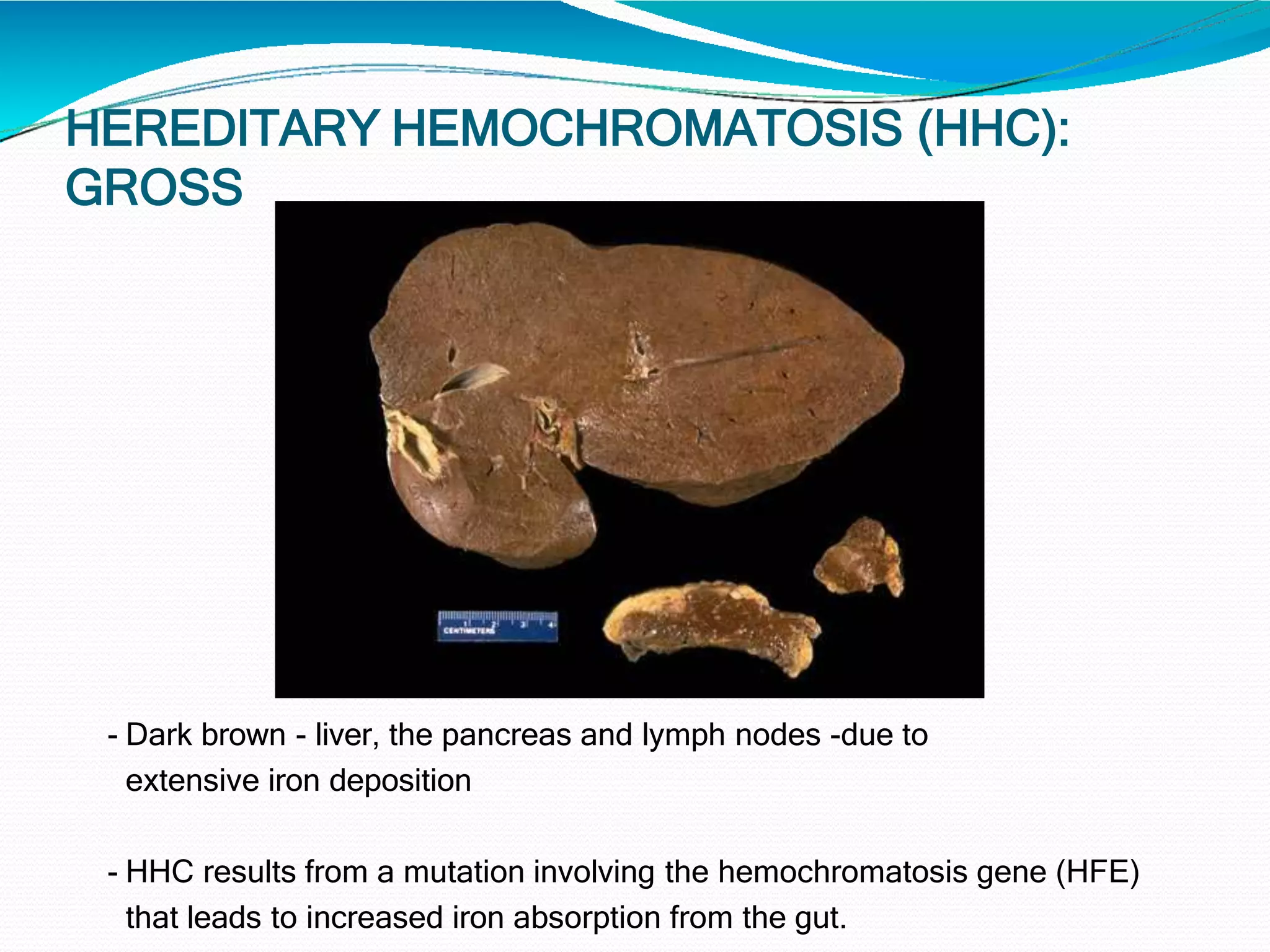 liver pathology.pptx