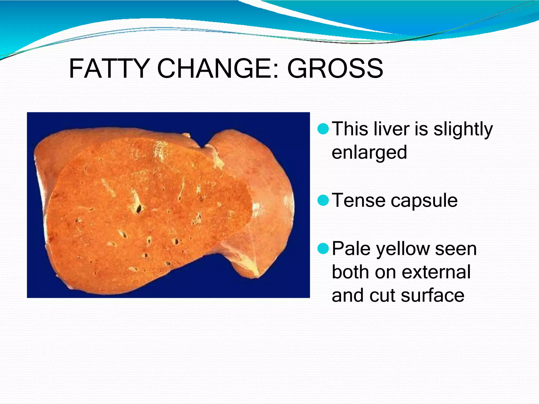 liver pathgology.pptx