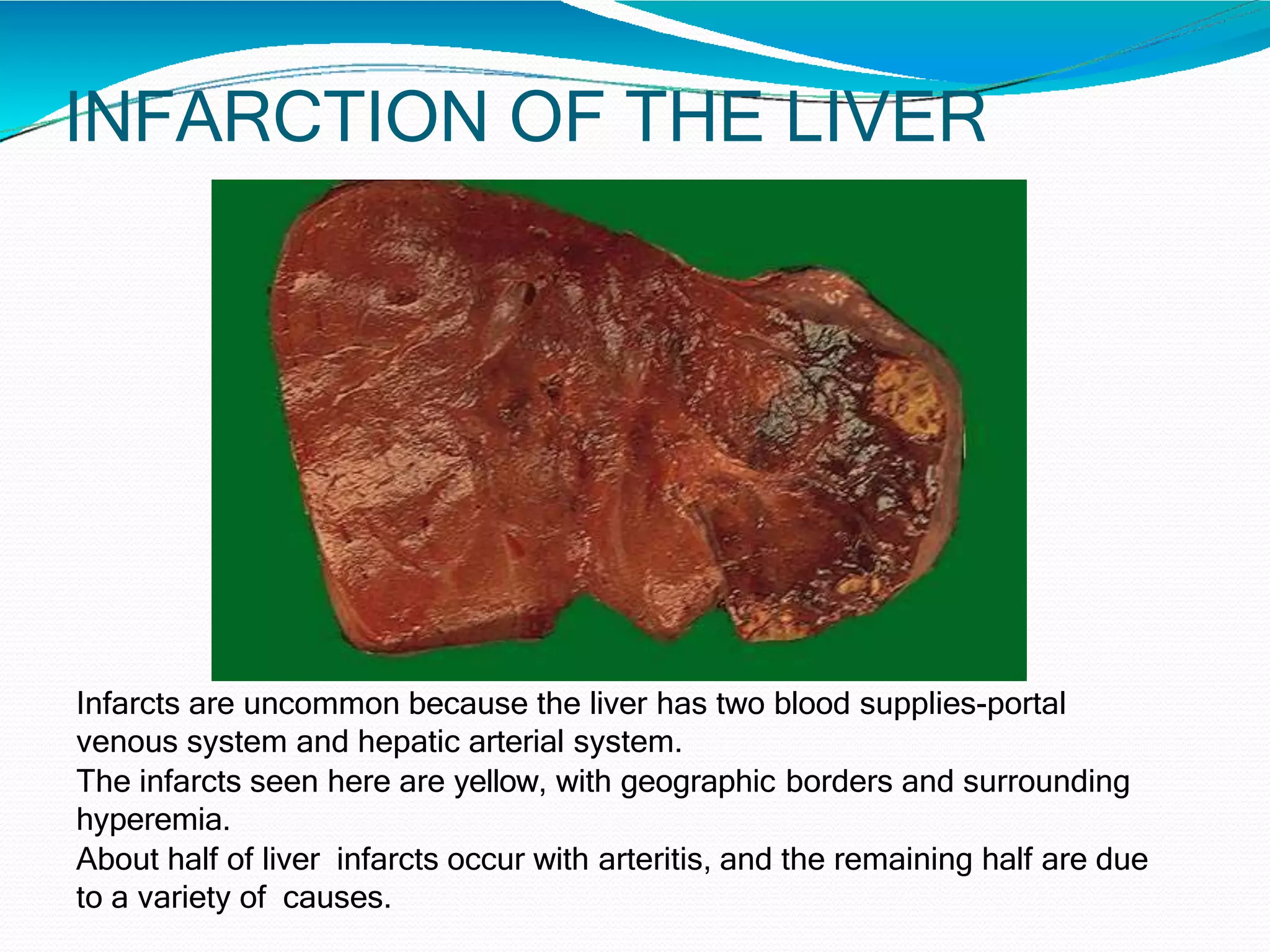 liver pathgology.pptx
