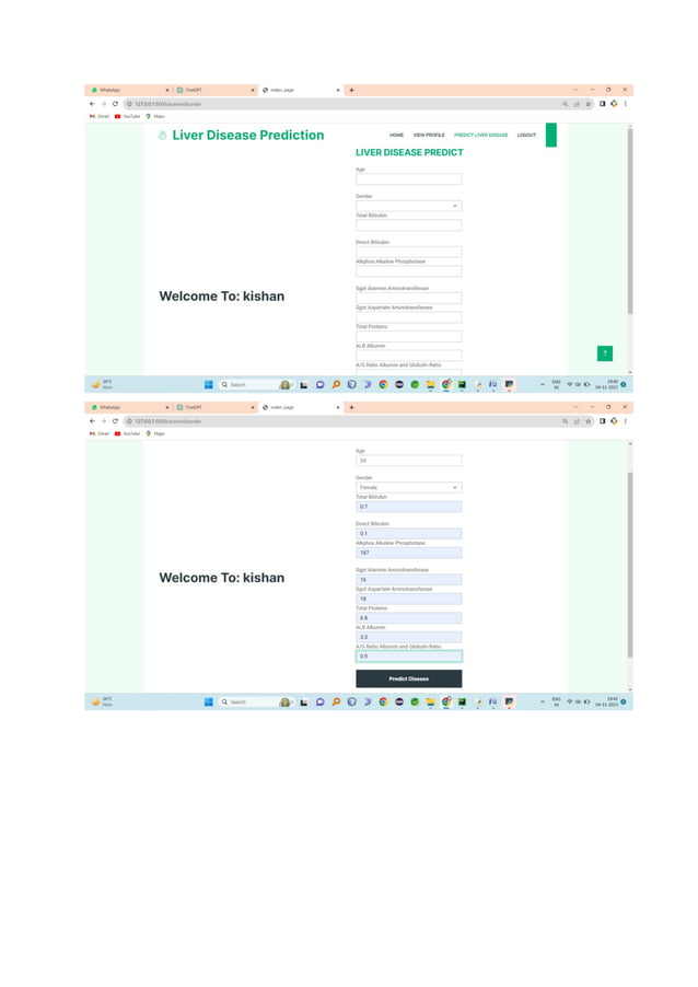 Liver Prediction Using Machine Learning Docx