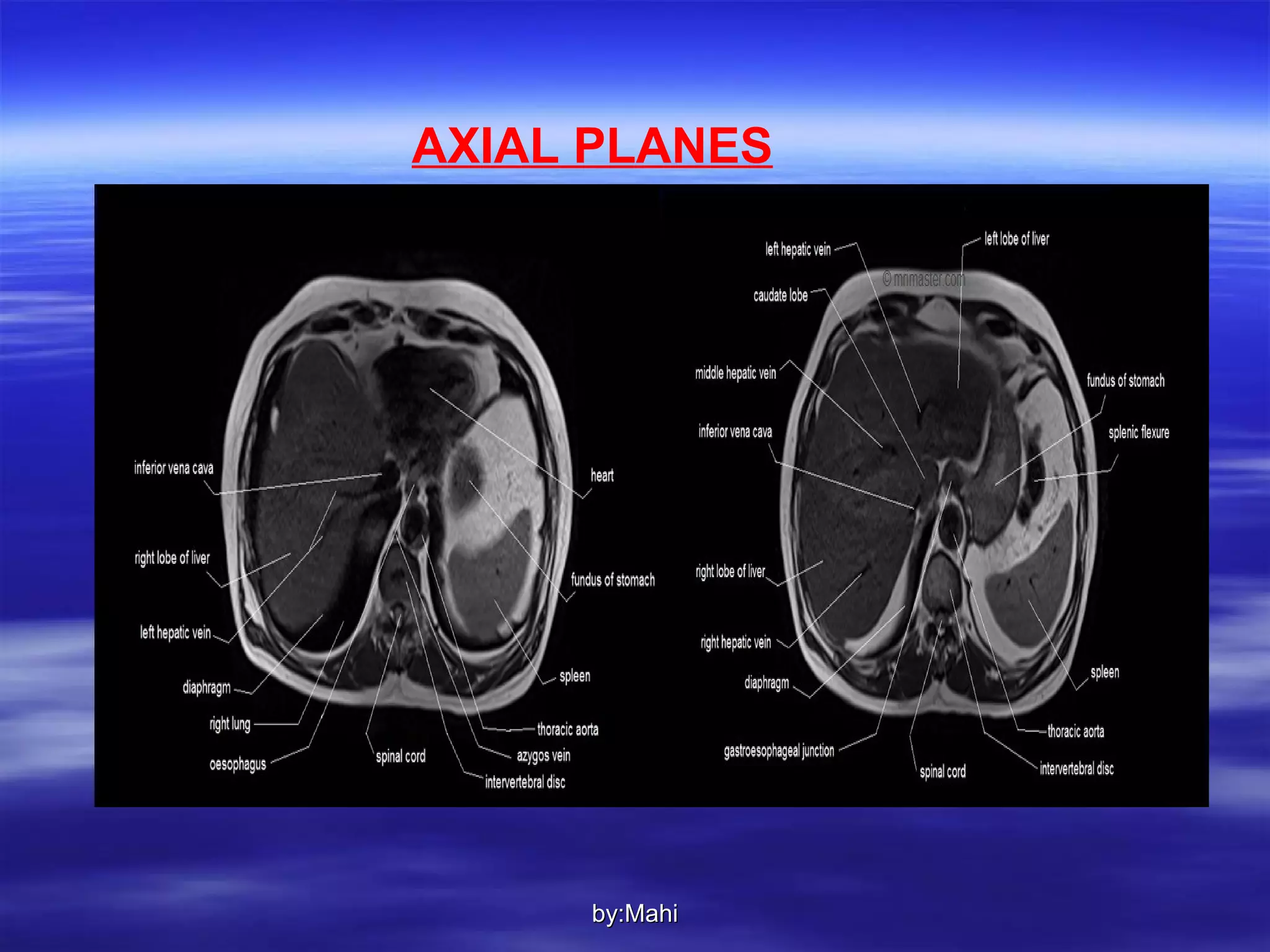 Liver radiology MRI | PPT