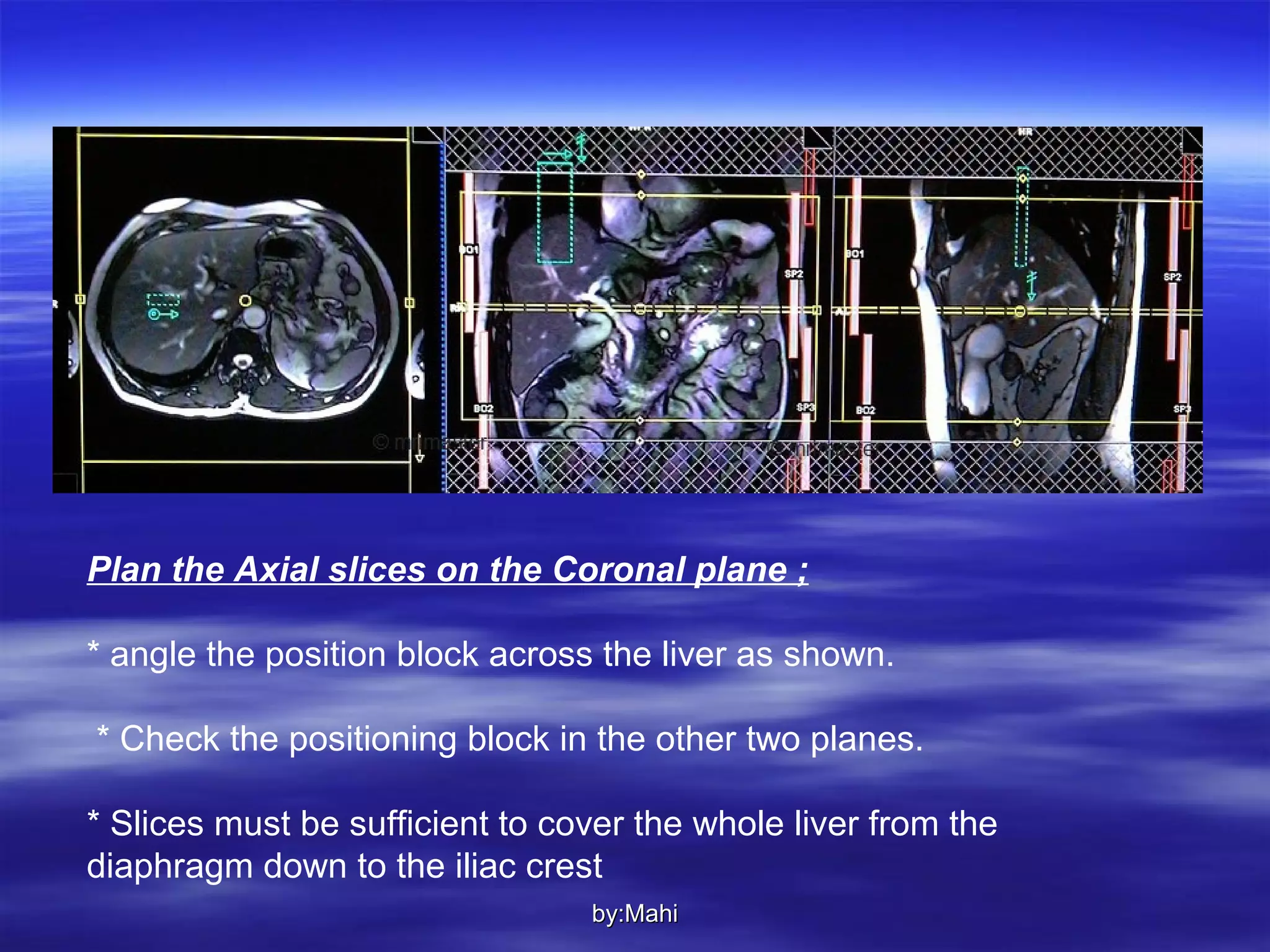 Liver radiology MRI | PPT