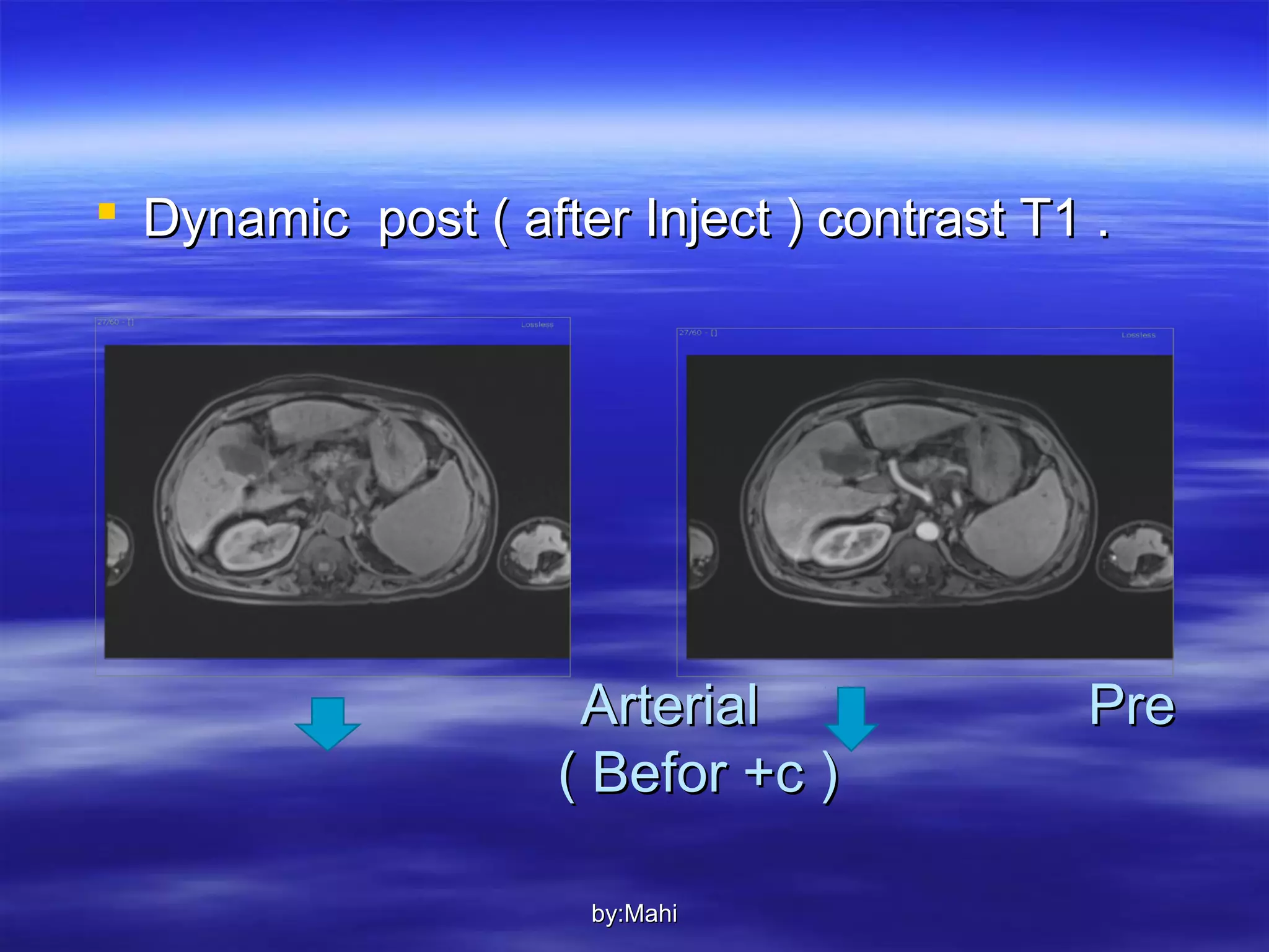 Liver radiology MRI | PPT