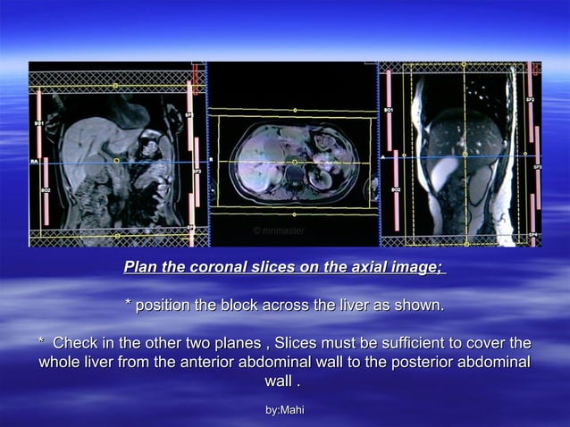 Liver radiology MRI | PPT
