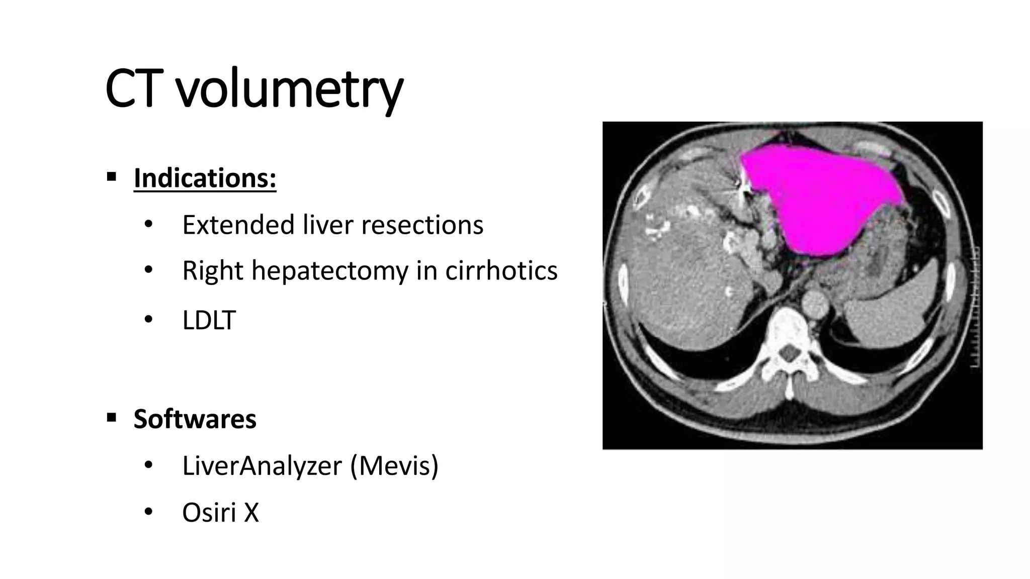 Liver resection and Metastasectomy.pptx