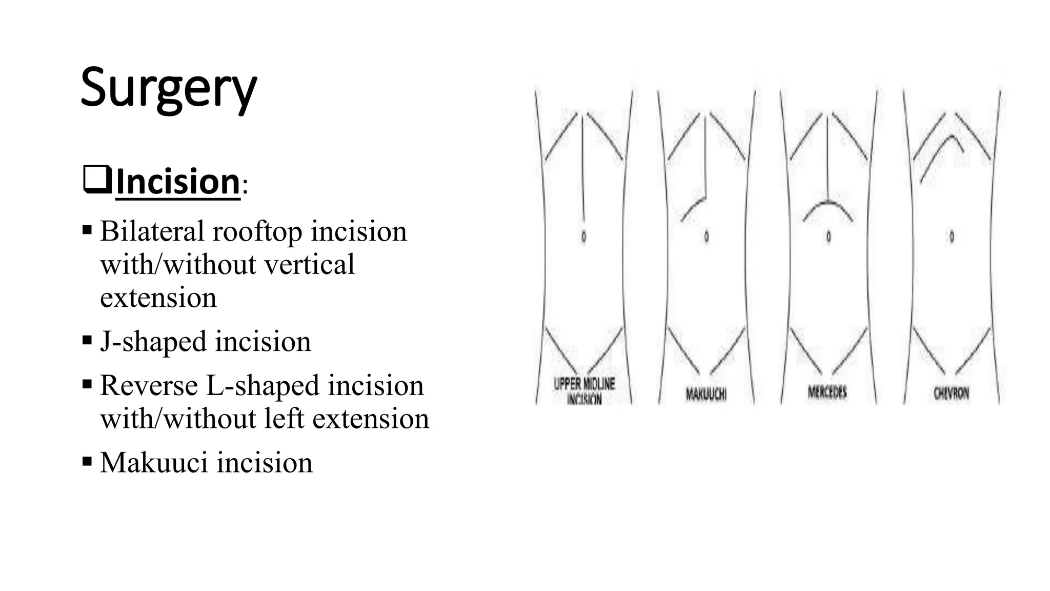 Liver resection and Metastasectomy.pptx