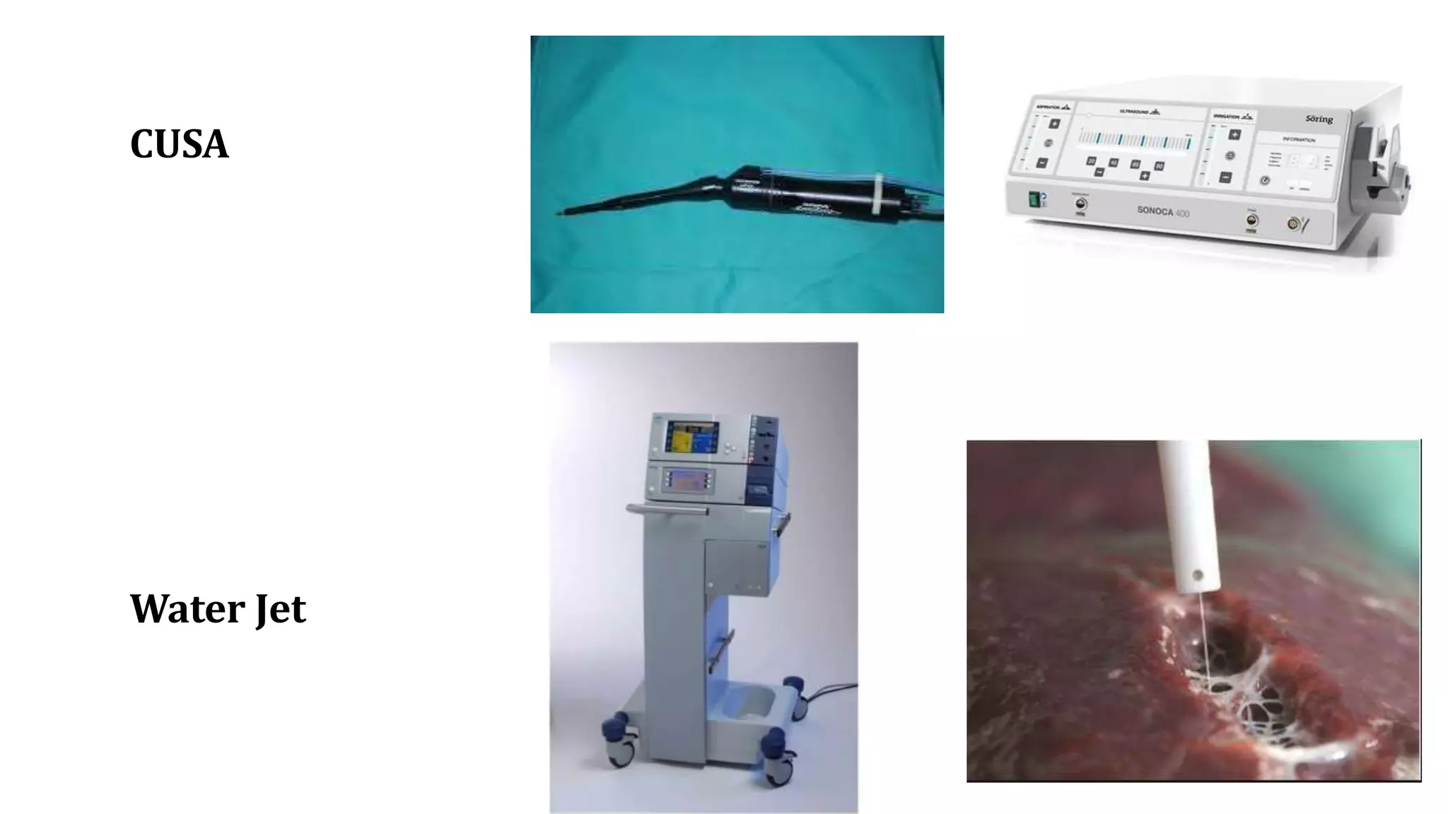 Liver resection and Metastasectomy.pptx
