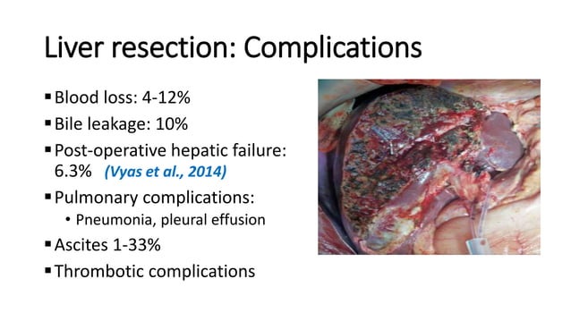 Liver resection and Metastasectomy.pptx