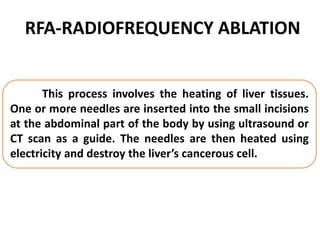 LOCAL ABLATIVE RADIOTHERAPY/LIVER METASTASIS SBRT | PPTX