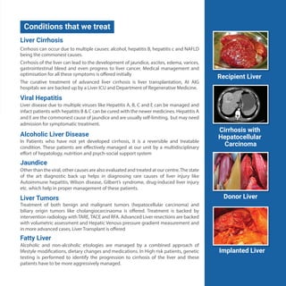 Liver Sciences | Hepatology | Liver Transplant | AIG Hospitals | PDF