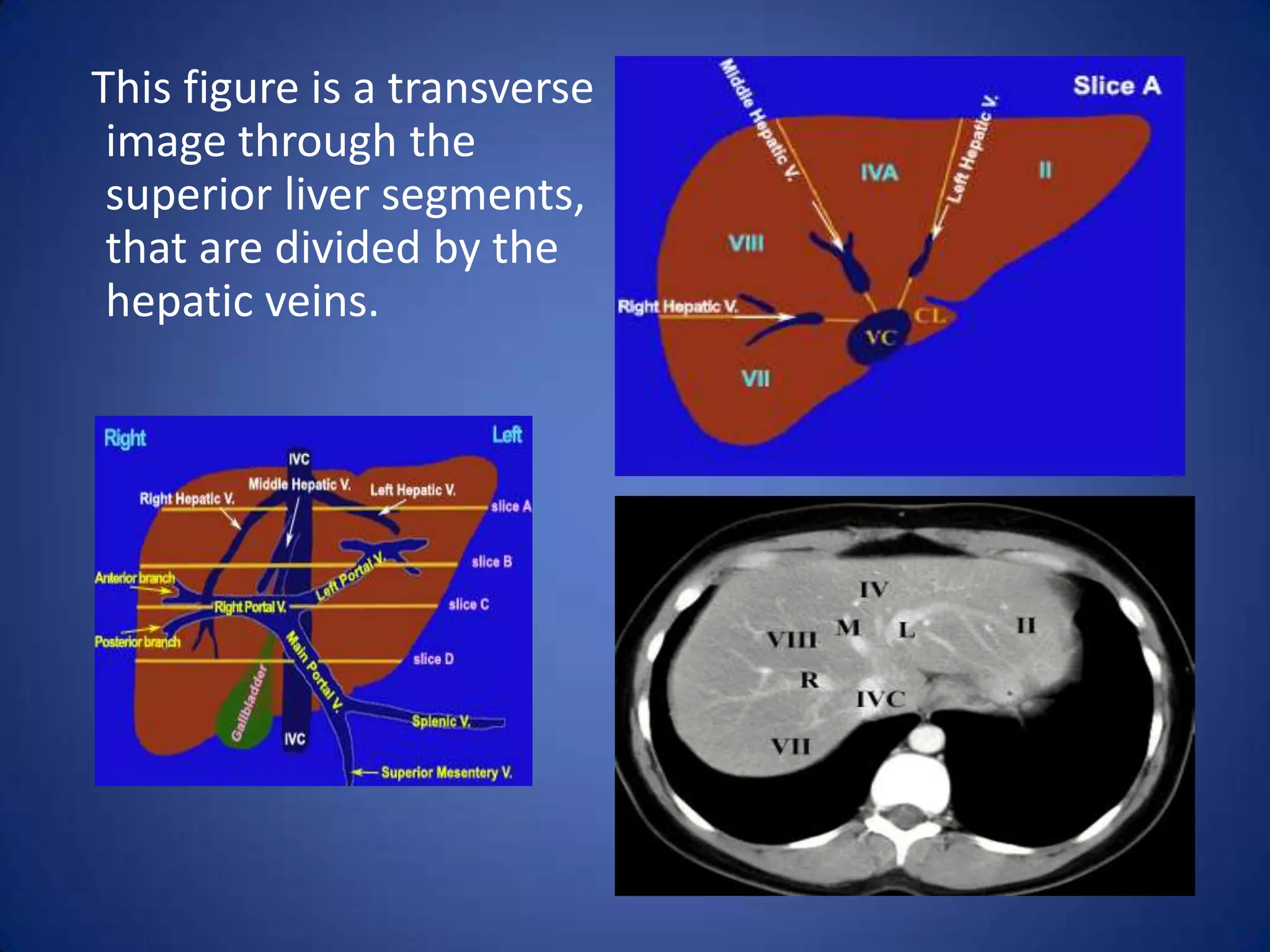 Liver Segmental Anatomy Ppt