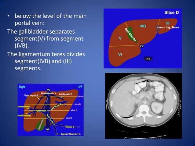 Liver Segmental Anatomy Ppt