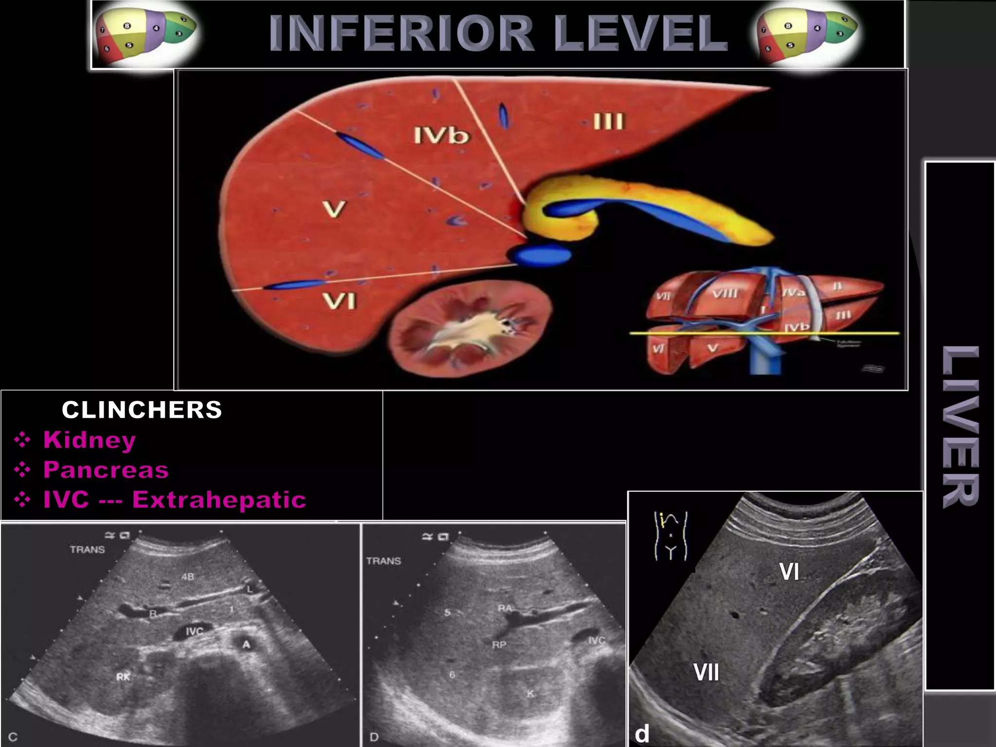 Liver segmental anatomy | PDF