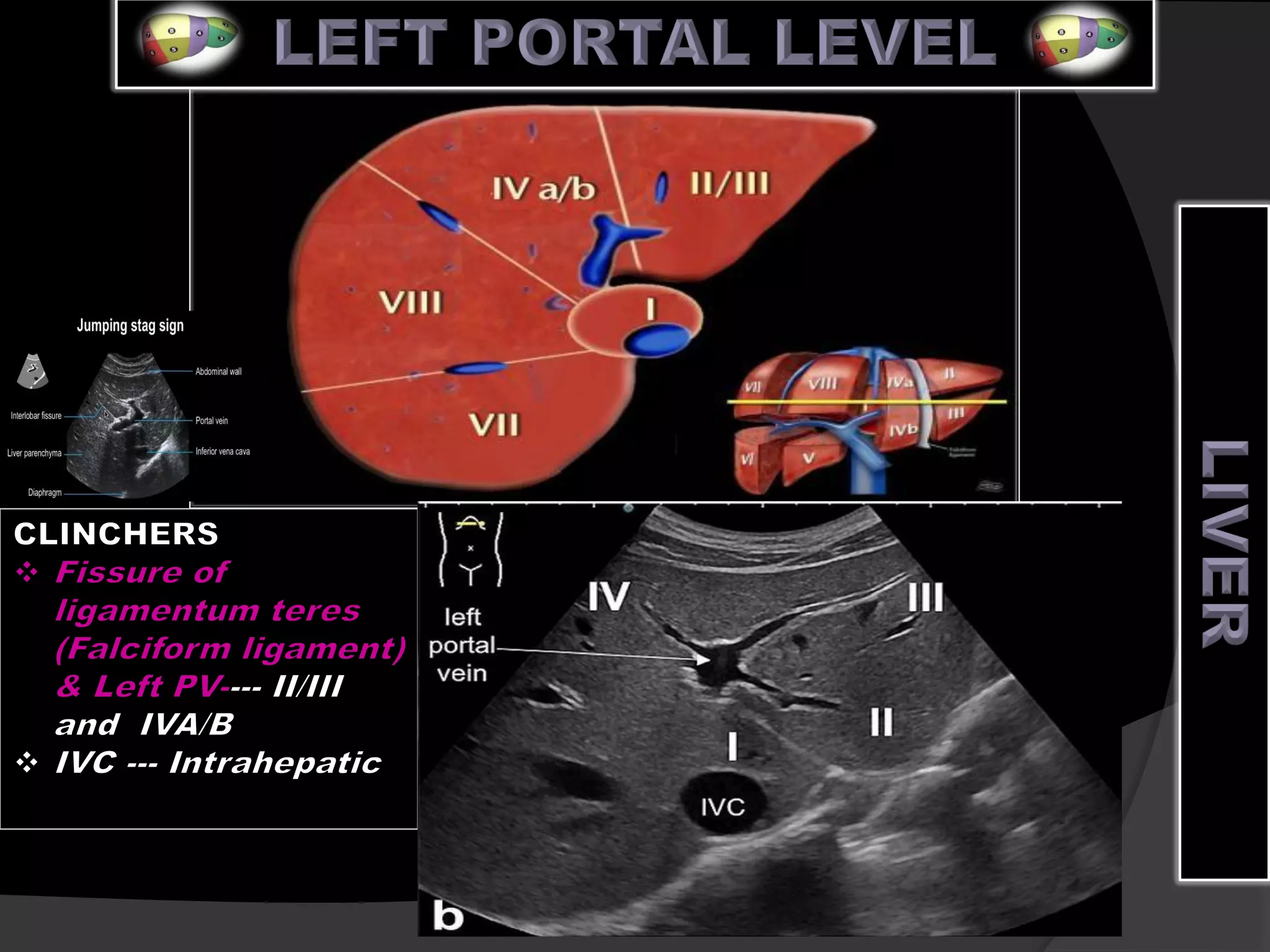 Liver segmental anatomy | PDF