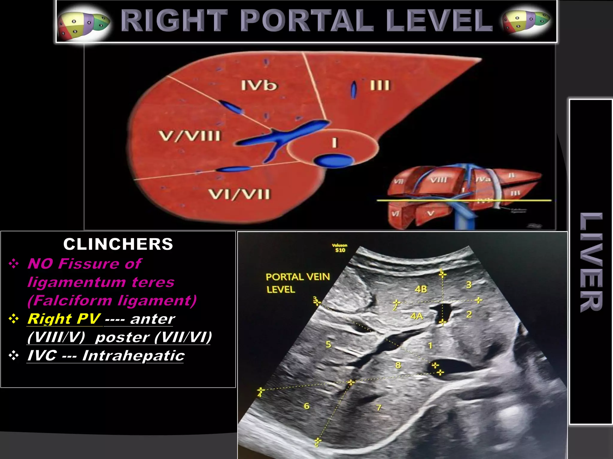 Liver segmental anatomy | PDF
