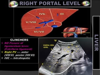 Liver segmental anatomy | PDF
