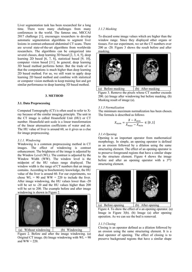 Liver Segmentationwith2du Net liver-segmentationwith2du-net
