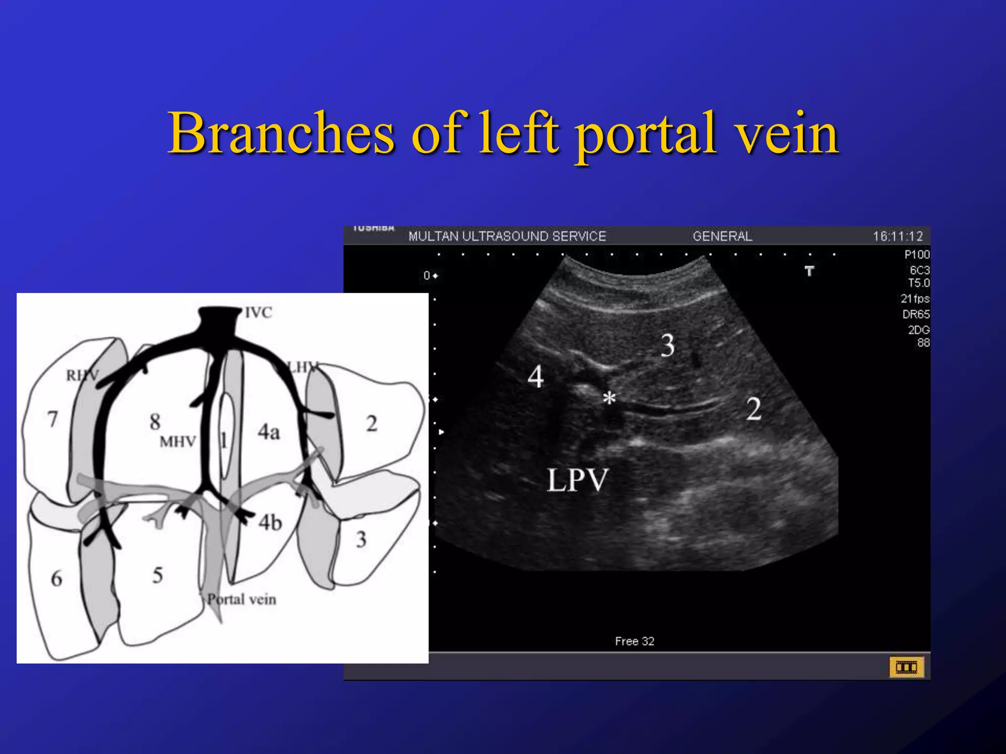 Liver segments on ultrasound | PPTX