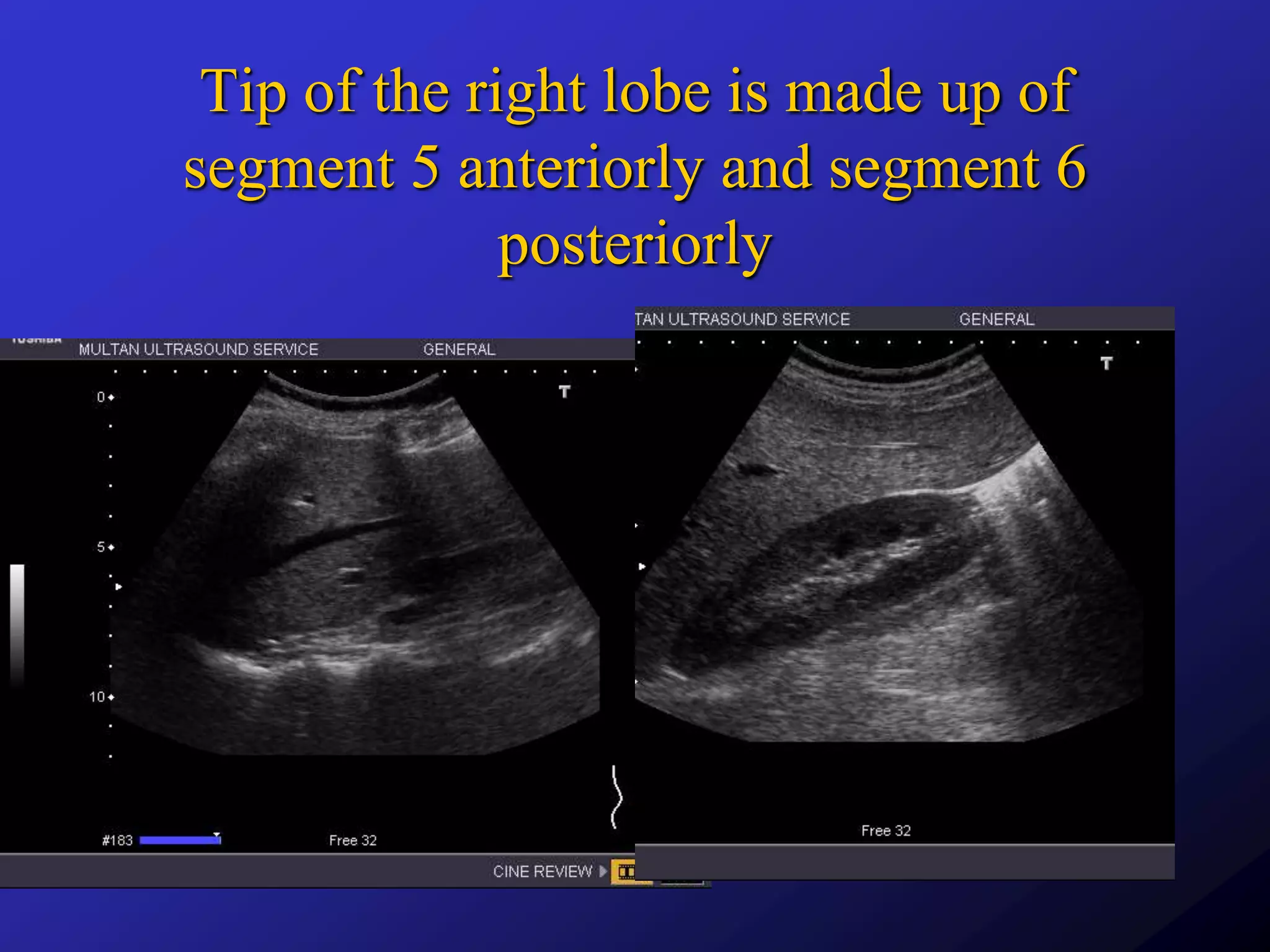Liver segments on ultrasound | PPTX