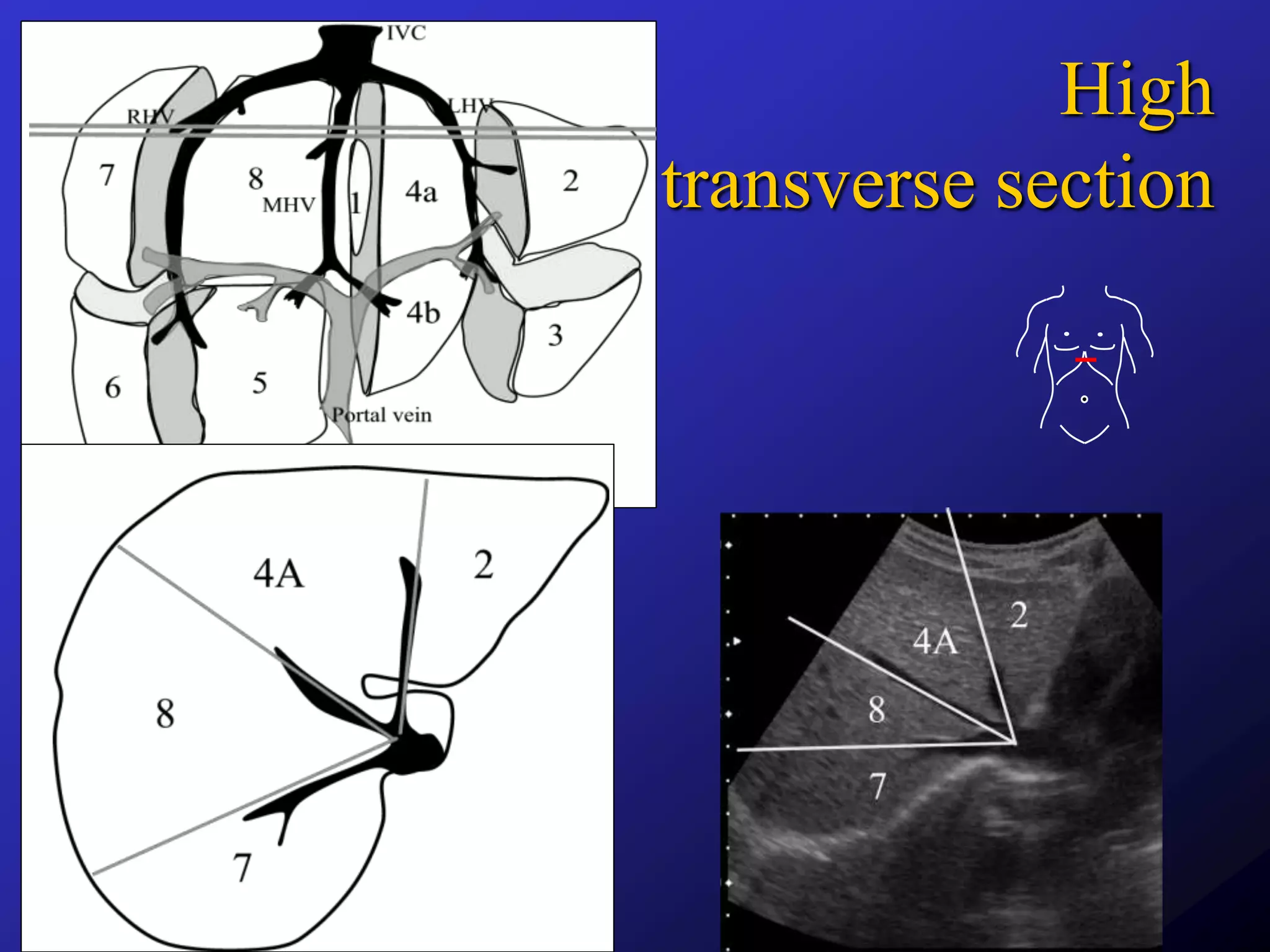 Liver Segments On Ultrasound Ppt