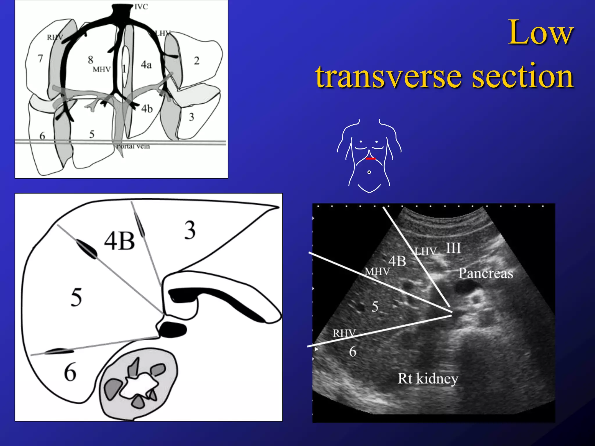 Liver segments on ultrasound | PPTX