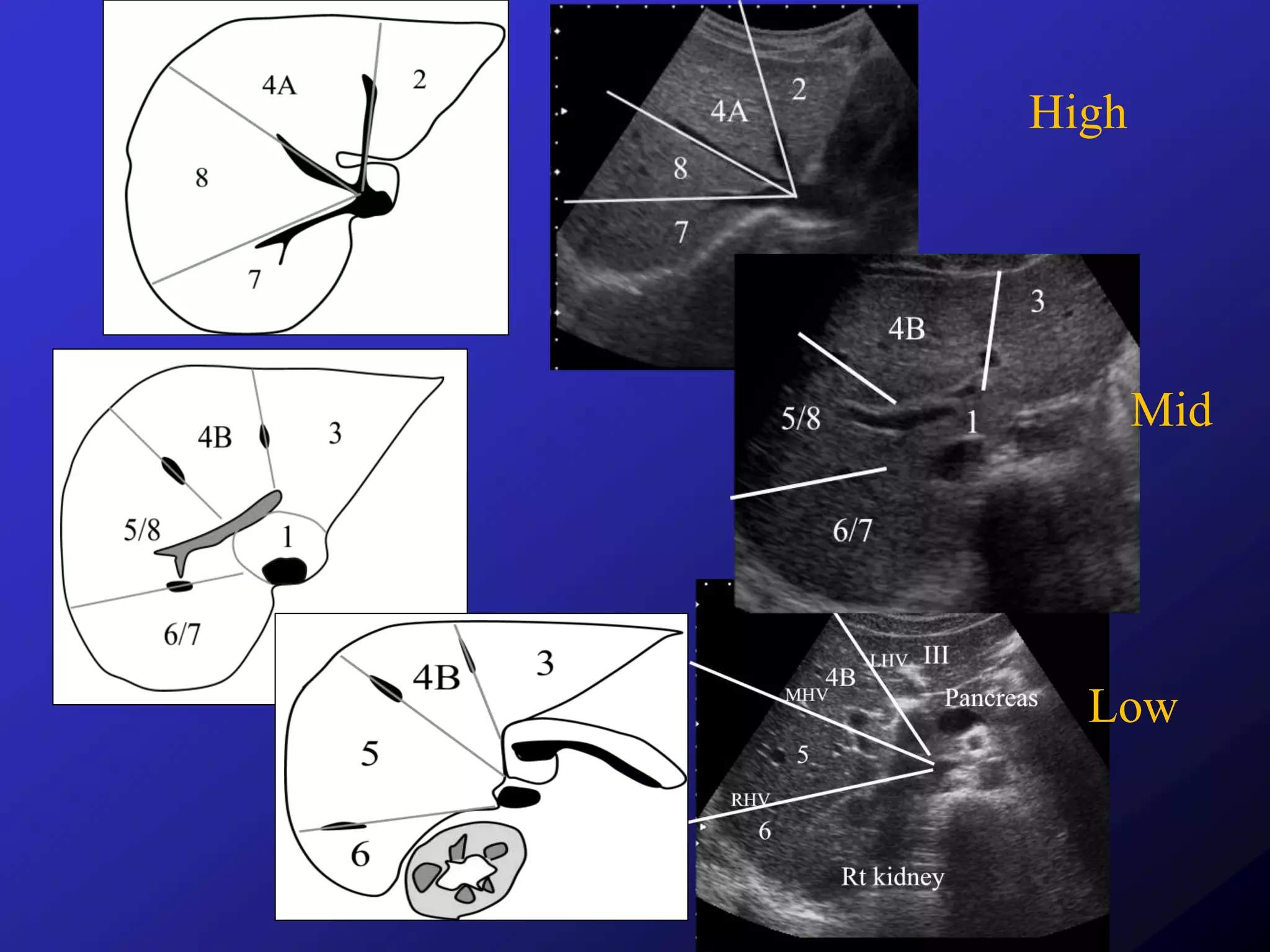 Liver Segments On Ultrasound Ppt