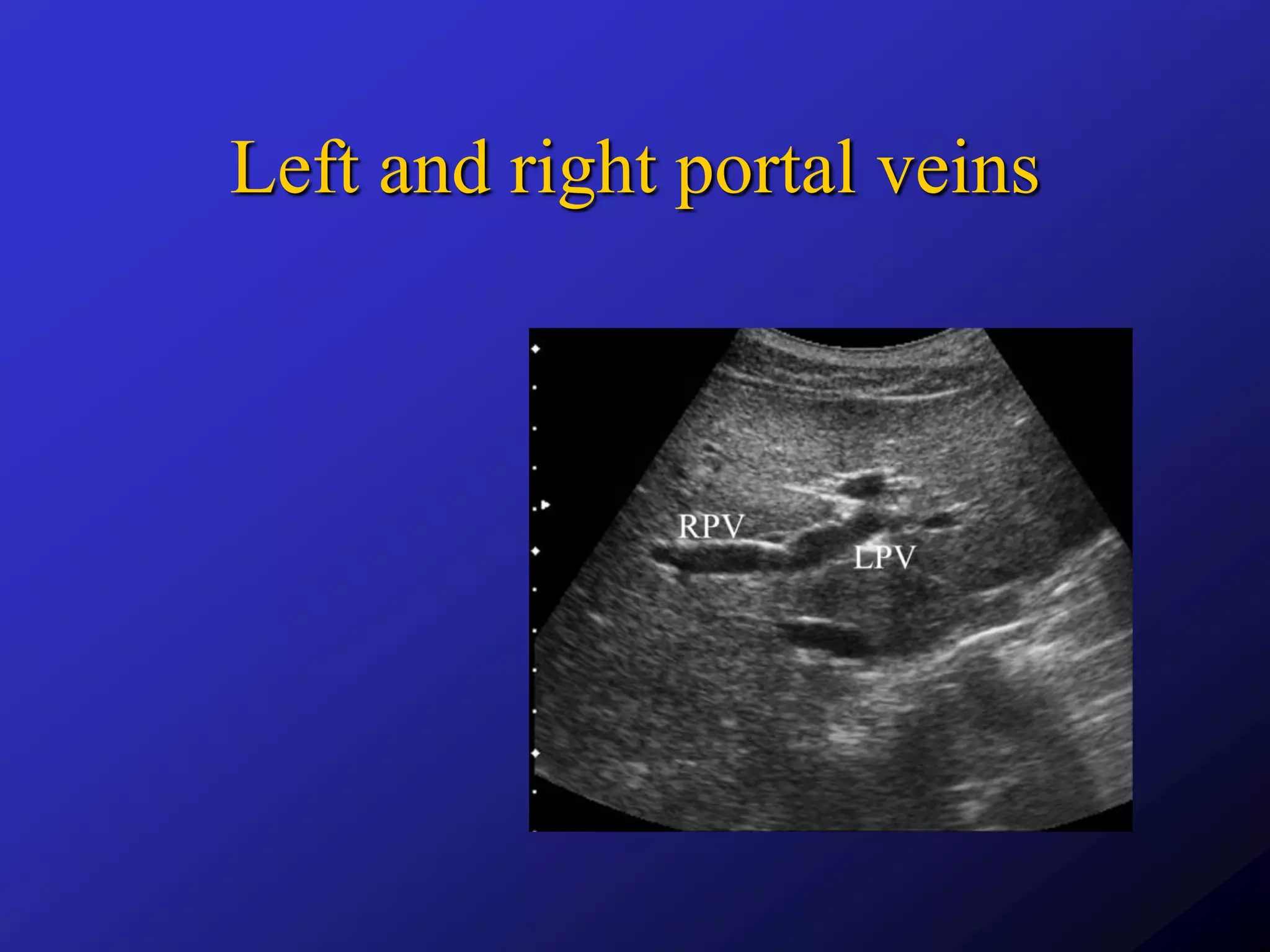 Liver Segments On Ultrasound Ppt