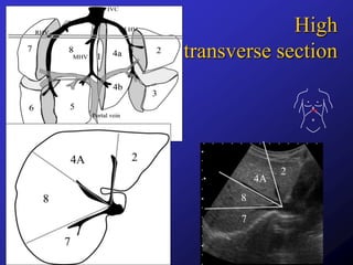 Liver segments on ultrasound | PPTX
