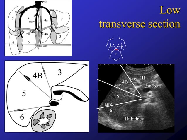 Liver segments on ultrasound | PPTX