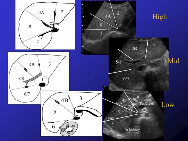 Liver segments on ultrasound | PPTX