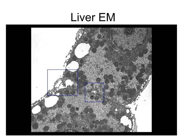 Liver slides | PDF