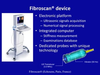 Liver stiffness measurement (fibroscan®) | PPTX