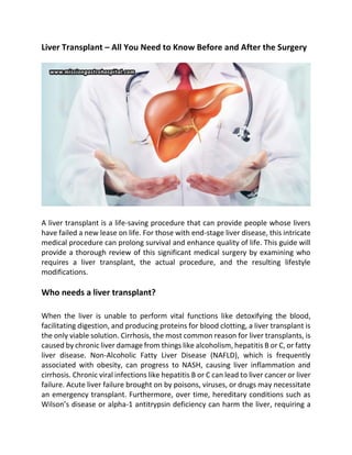 Liver Transplant – All You Need To Know Before And After The Surgery.pdf