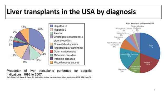 Liver transplantation; notes of DM/DNB/Specialists | PDF | Lung and ...