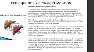 liver transplantation.pptx