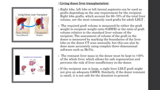 liver transplantation.pptx