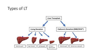 Liver Transplantation, intro steps, types | PPT